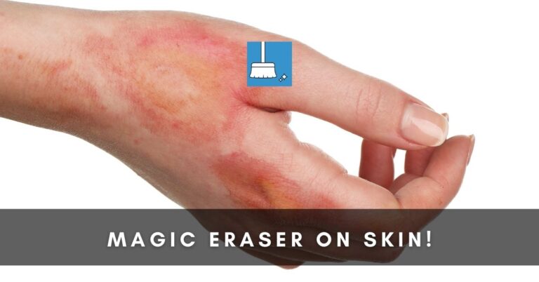 Magic Eraser On Skin! What To Do? (5 Steps!)